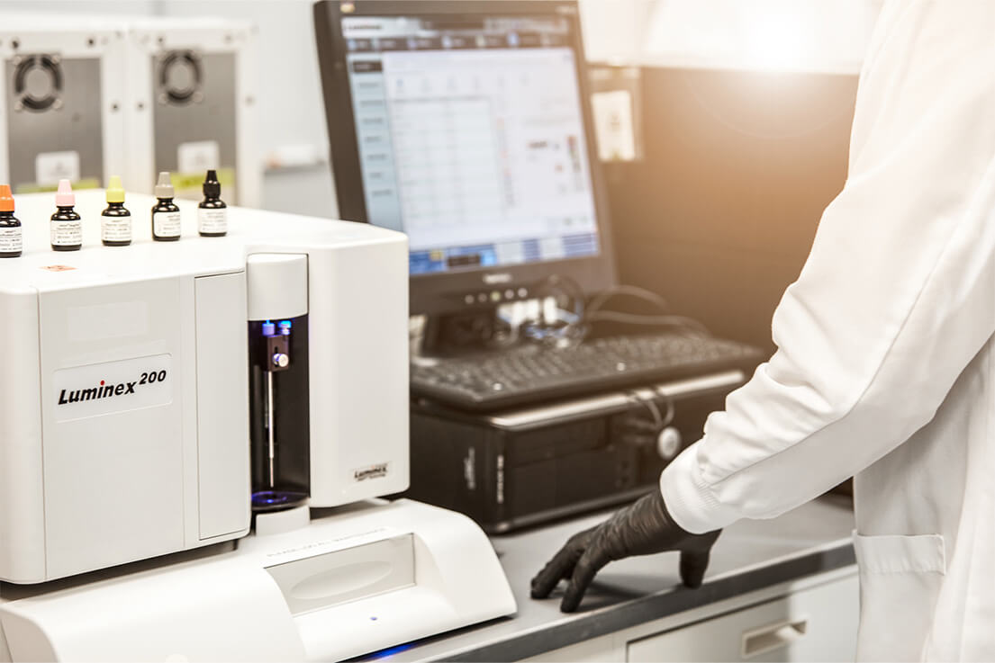 xPONENT® Software Solutions for Luminex® Systems | Diasorin